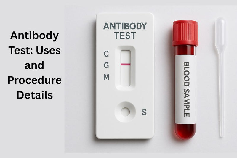 Antibody Tests What Your Blood Reveals – AstorScientific